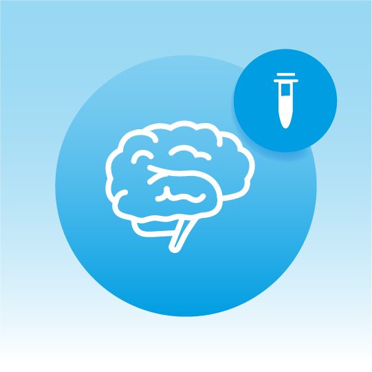 Standard Human CSF Lipidomics - Lipotype GmbH