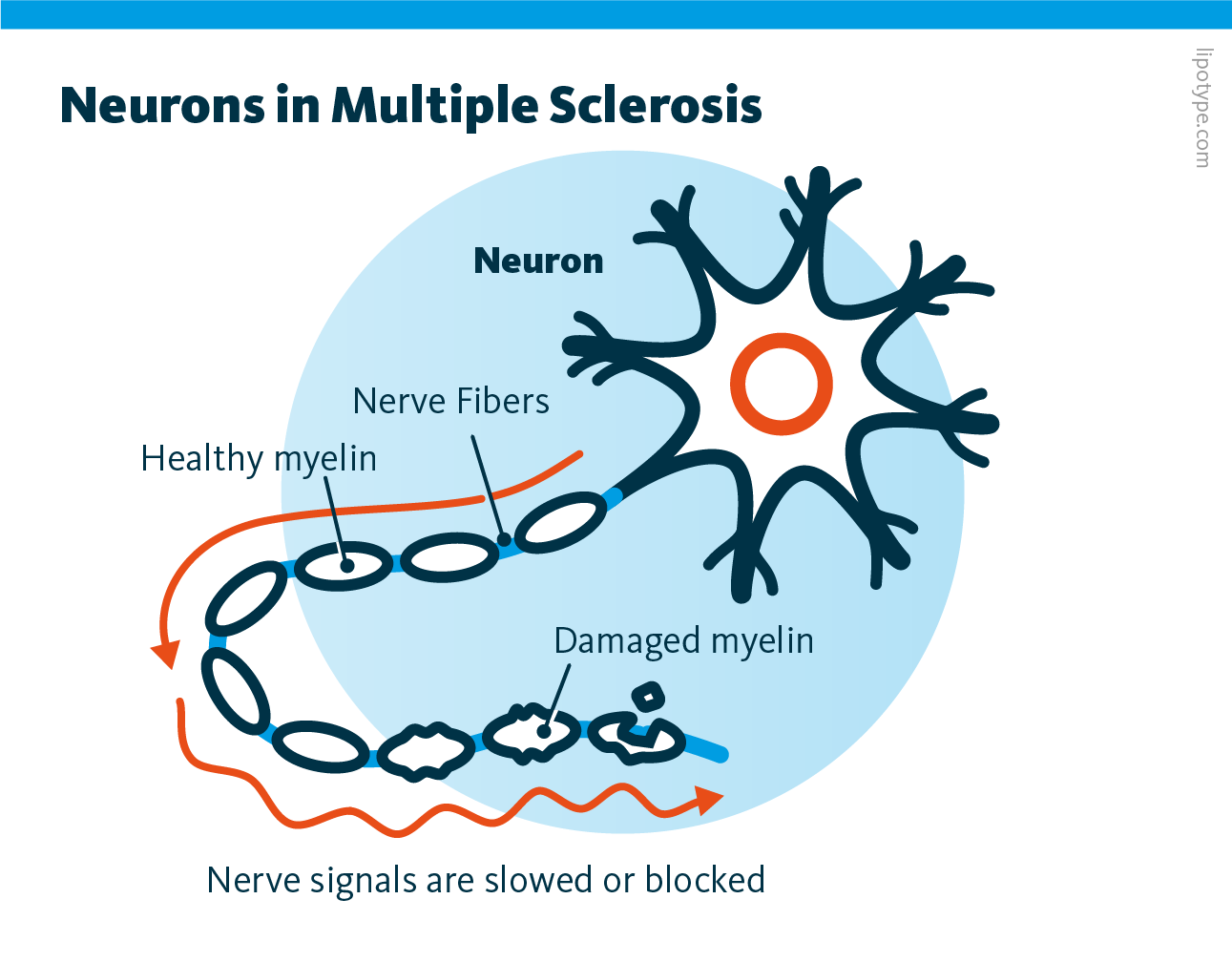 Lipid Biomarkers for Multiple Sclerosis - Neuroinflammation and ...