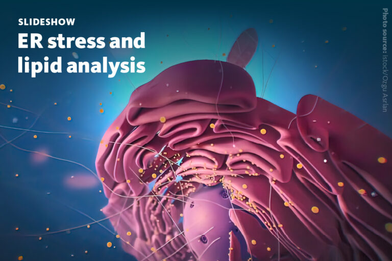 Endoplasmic reticulum stress & lipid metabolism - Lipotype GmbH