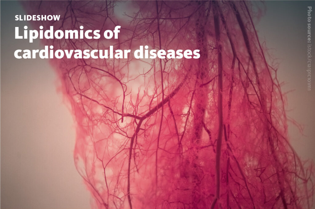 Lipidomics of cardiovascular diseases - Lipotype GmbH